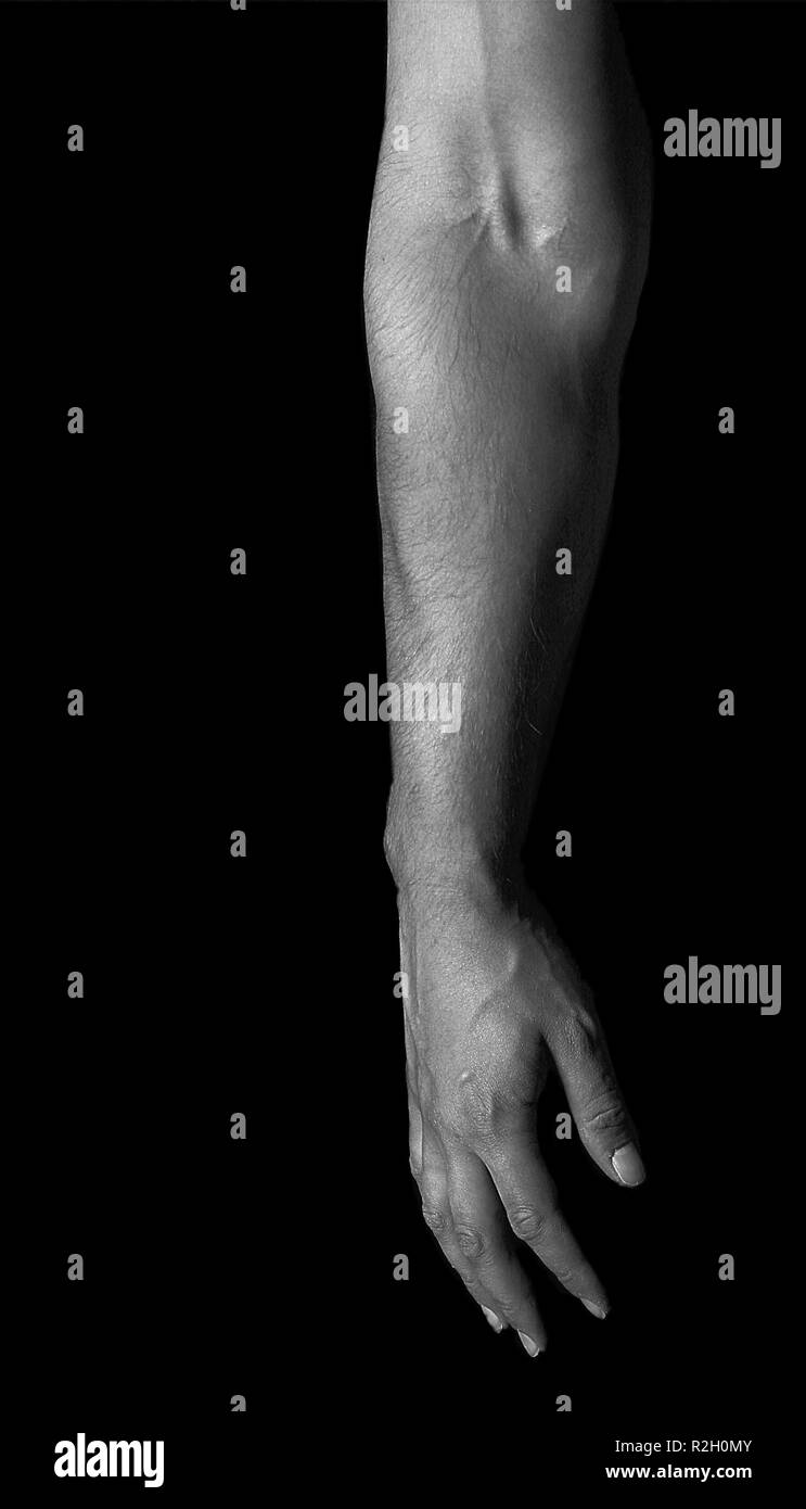 Muscles of the forearm Black and White Stock Photos & Images - Alamy