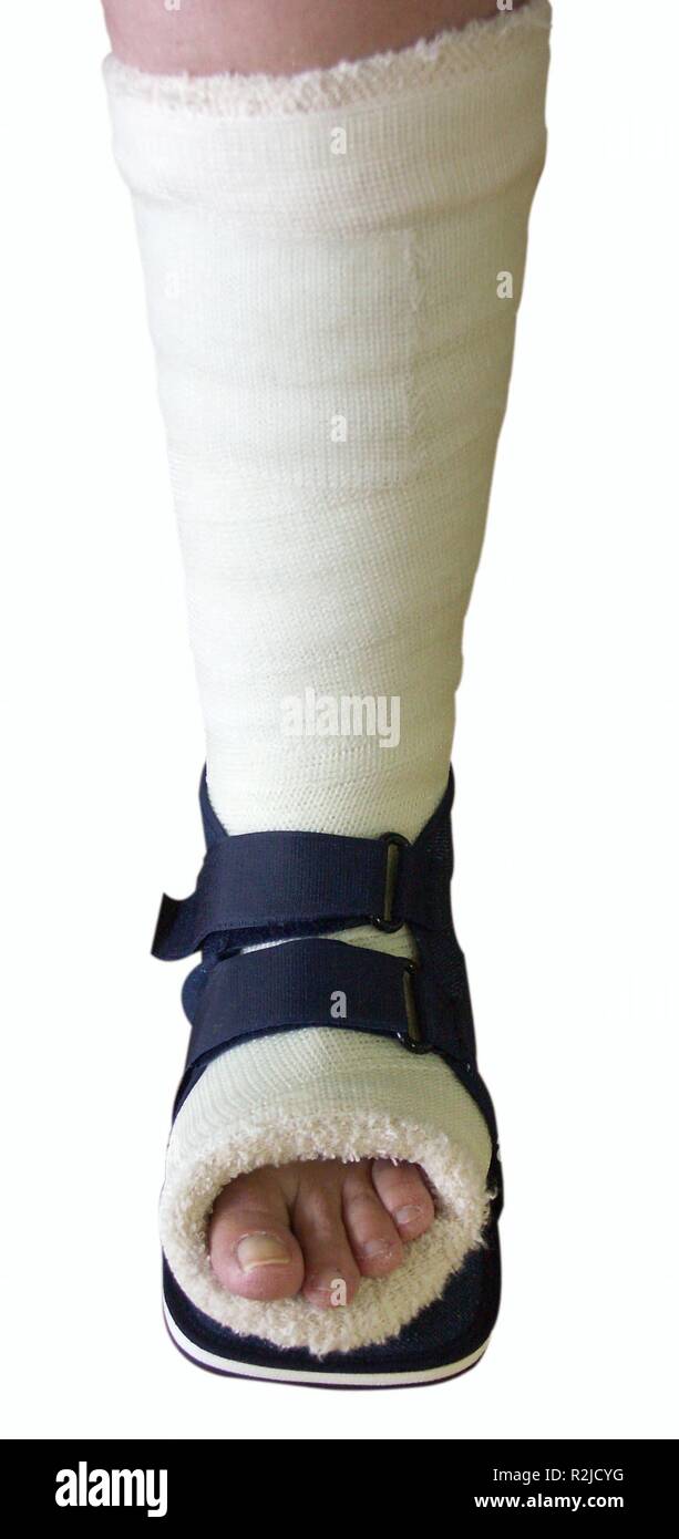 Gehgips hi-res stock photography and images - Alamy