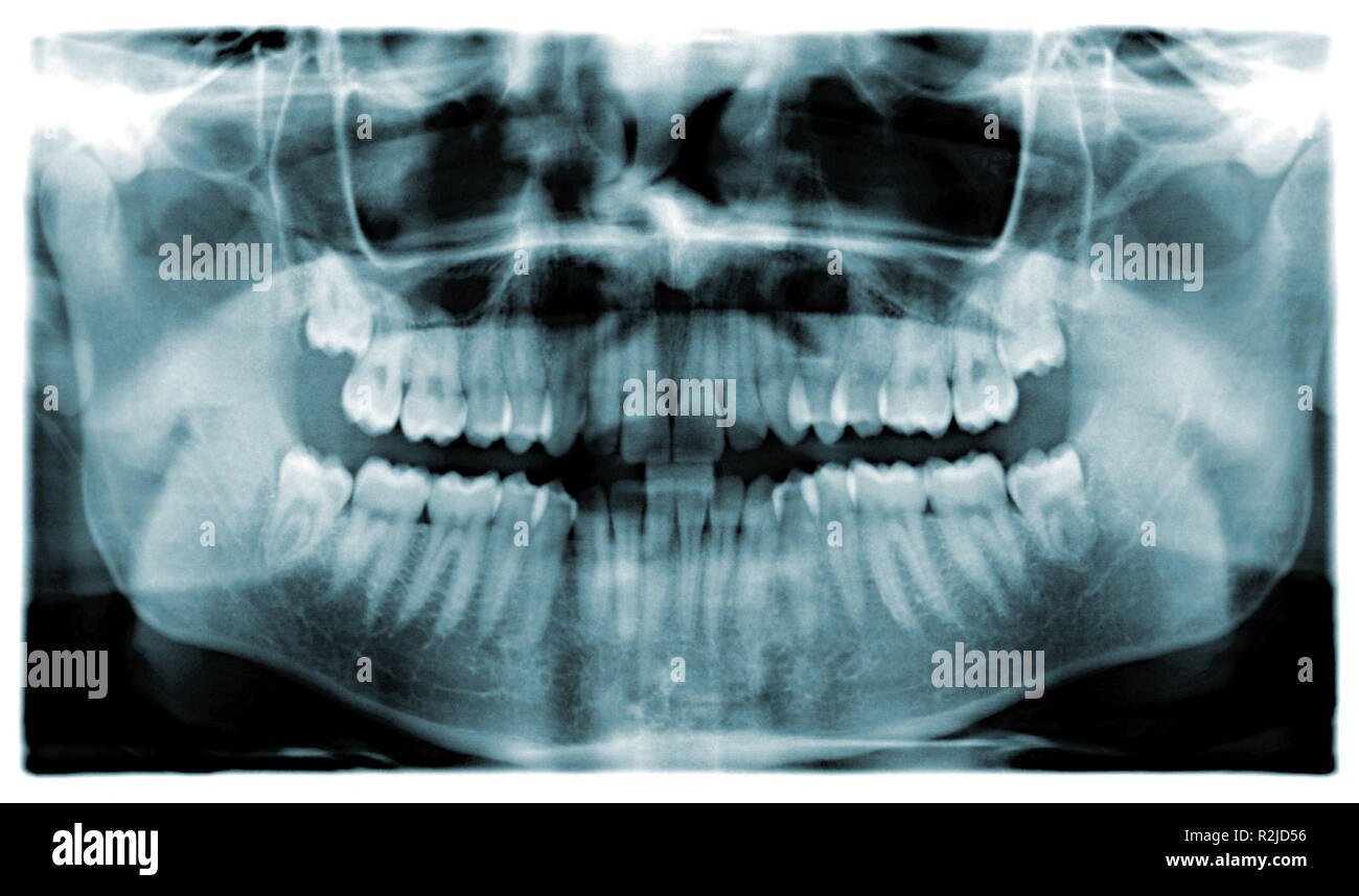 Ra ntgen hi-res stock photography and images - Alamy