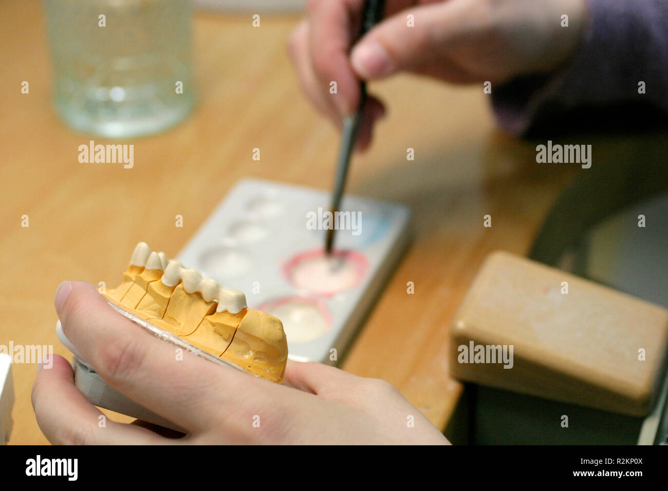 tooth model of a jaw Stock Photo - Alamy