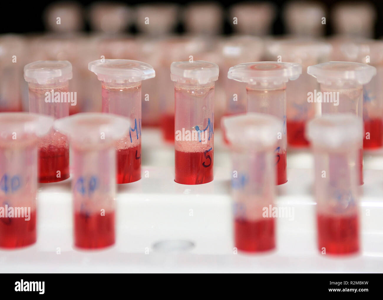 Laktattest hi-res stock photography and images - Alamy