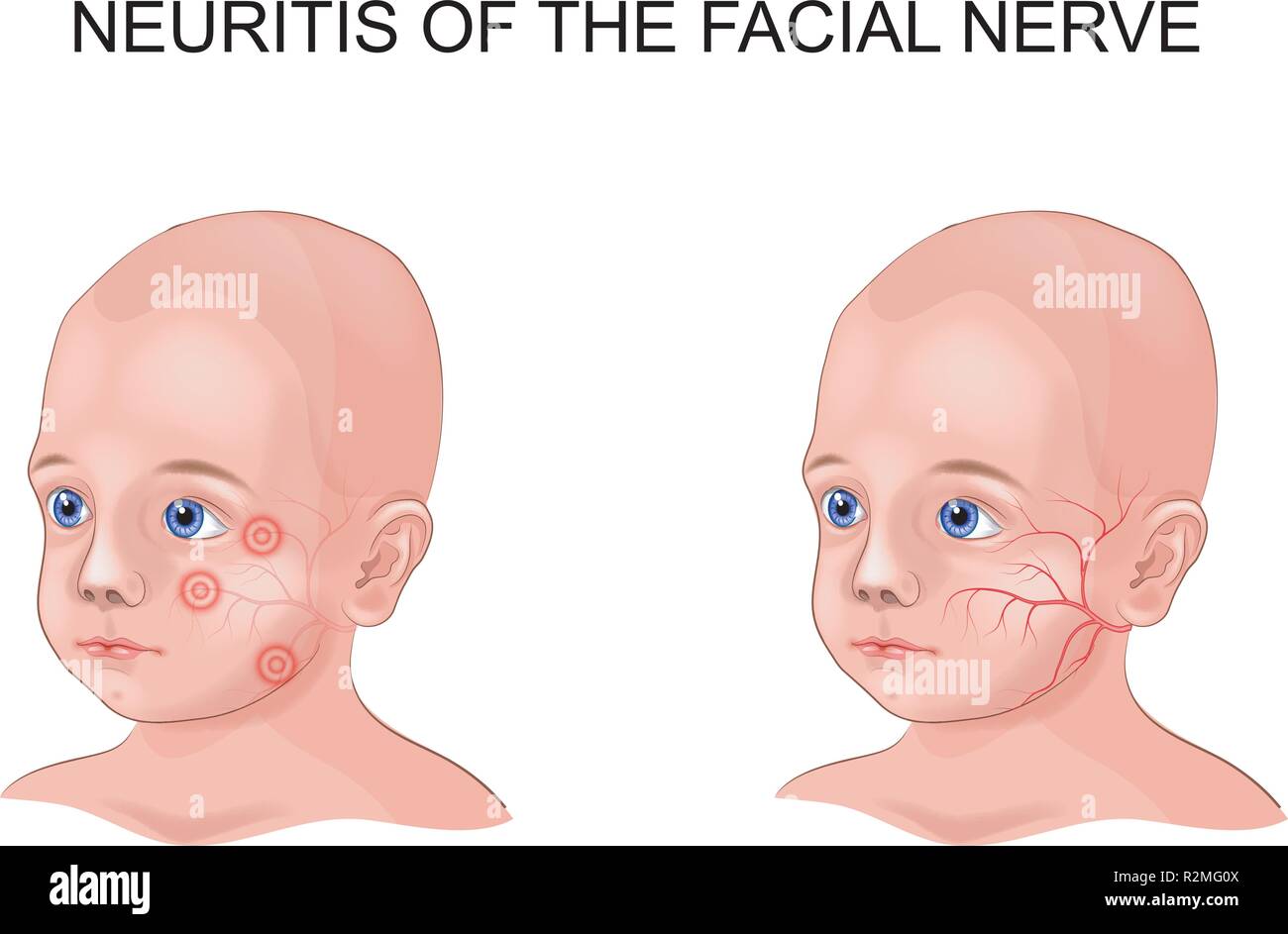 Facial nerve hi-res stock photography and images - Alamy