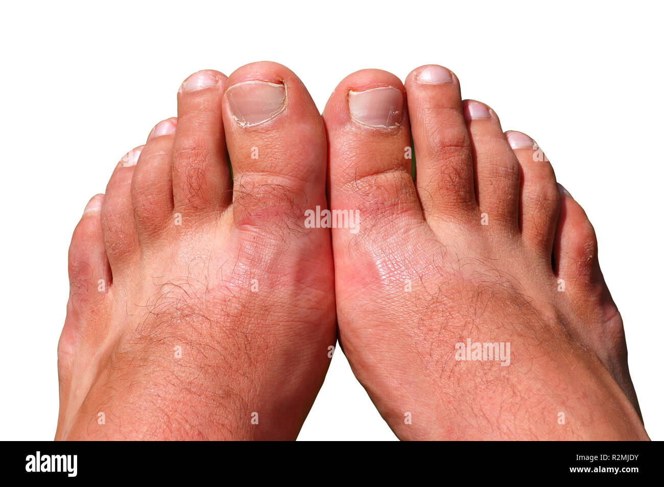 Tanned feet Cut Out Stock Images & Pictures - Alamy