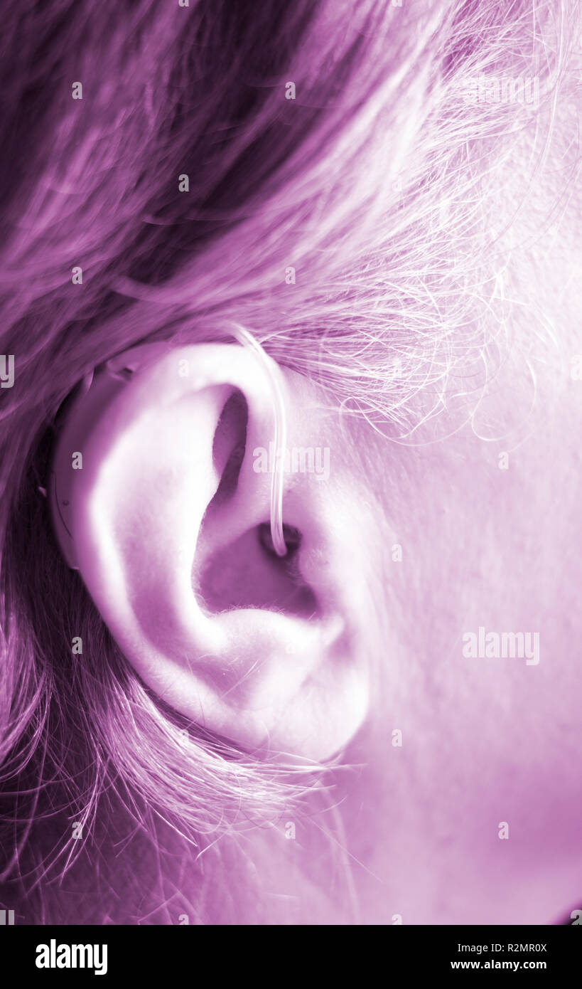 Deaf lady with modern technology digital hearing aid in her ear Stock ...