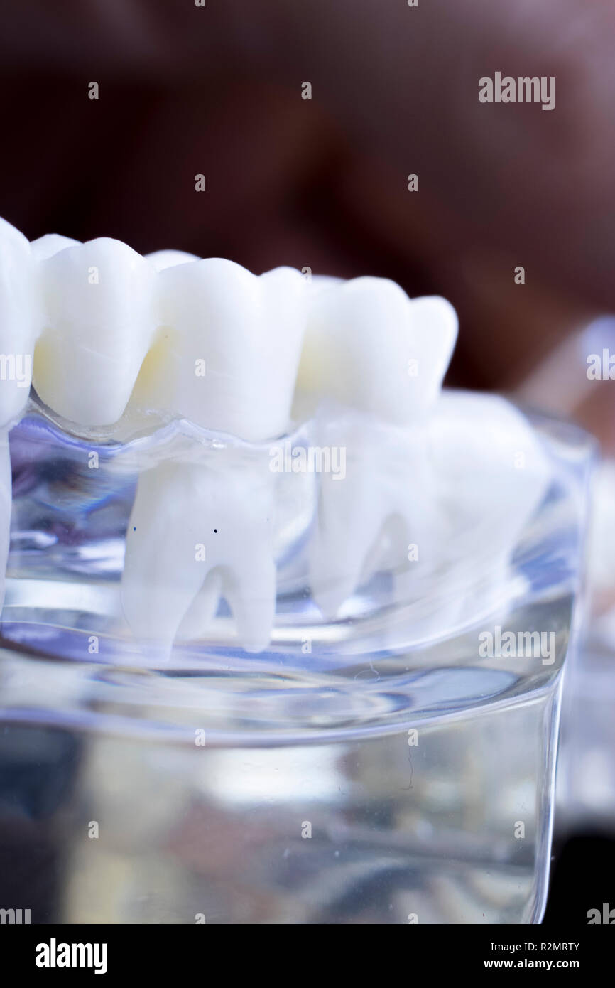 Dentist dental teeth teaching model showing each tooth and gum for ...
