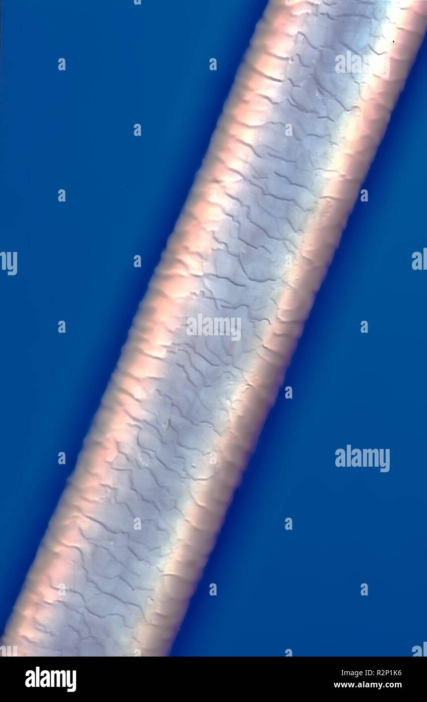 Haarschuppen hi-res stock photography and images - Alamy