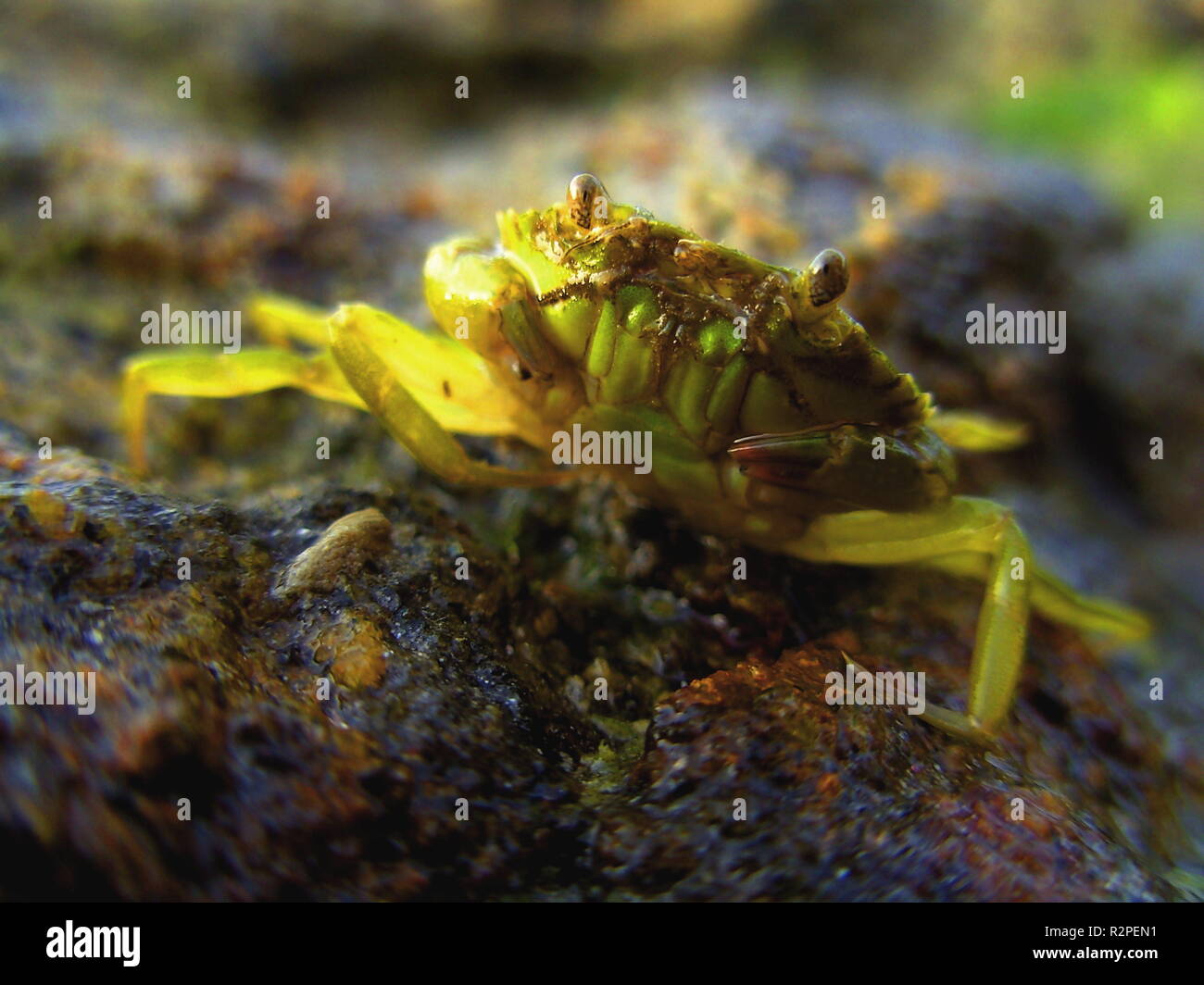 Leg cancer hi-res stock photography and images - Alamy