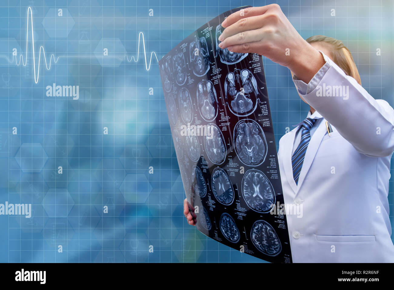 woman doctor holding CT scan film for diagnosis problem in brain Stock ...
