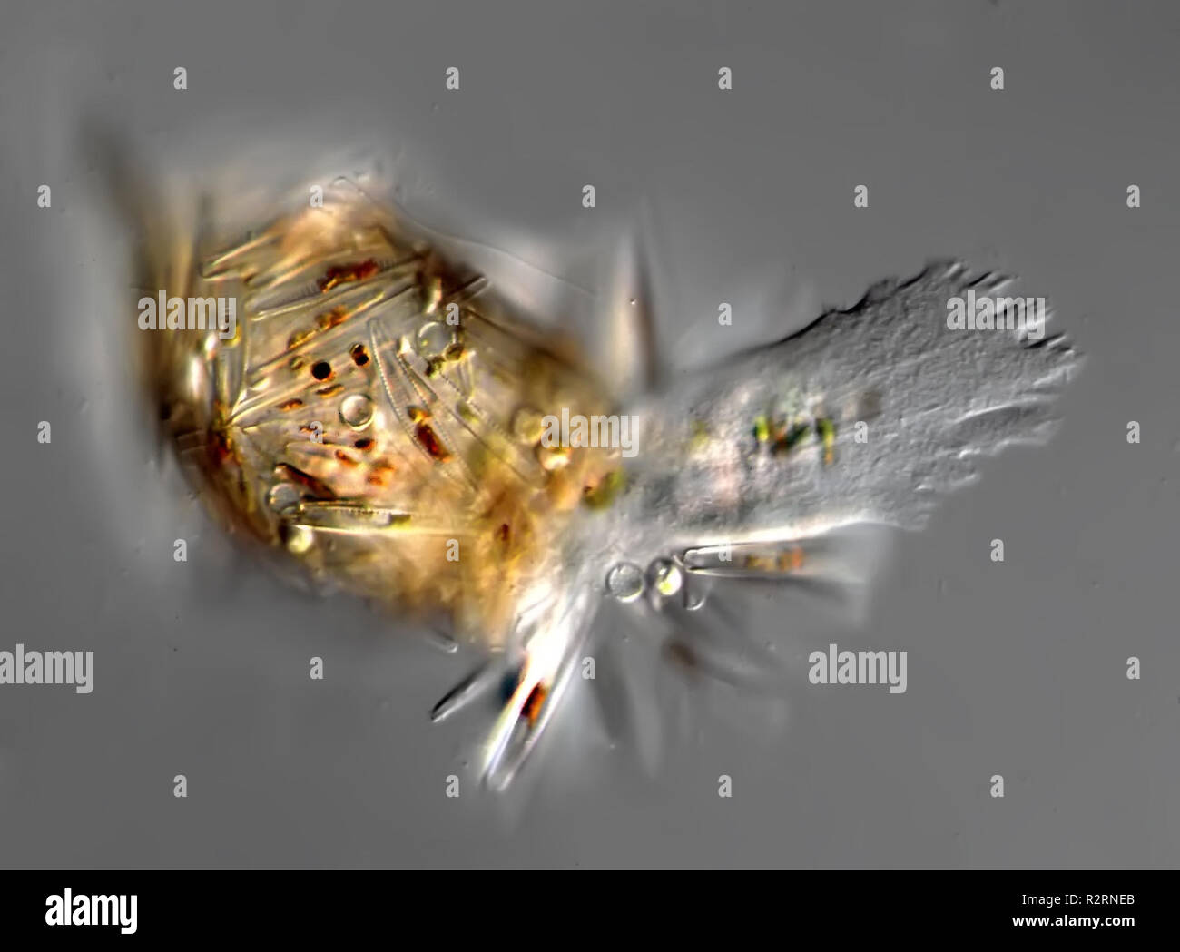 schalenamÃ¶be (difflugia bacillariarum Stock Photo - Alamy