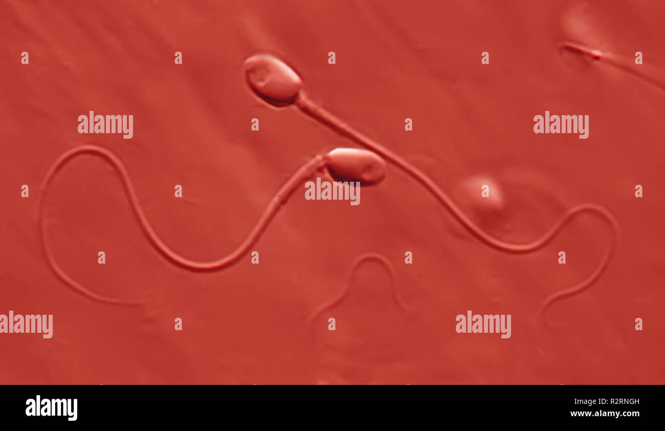 Ejaculation hi-res stock photography and images - Alamy