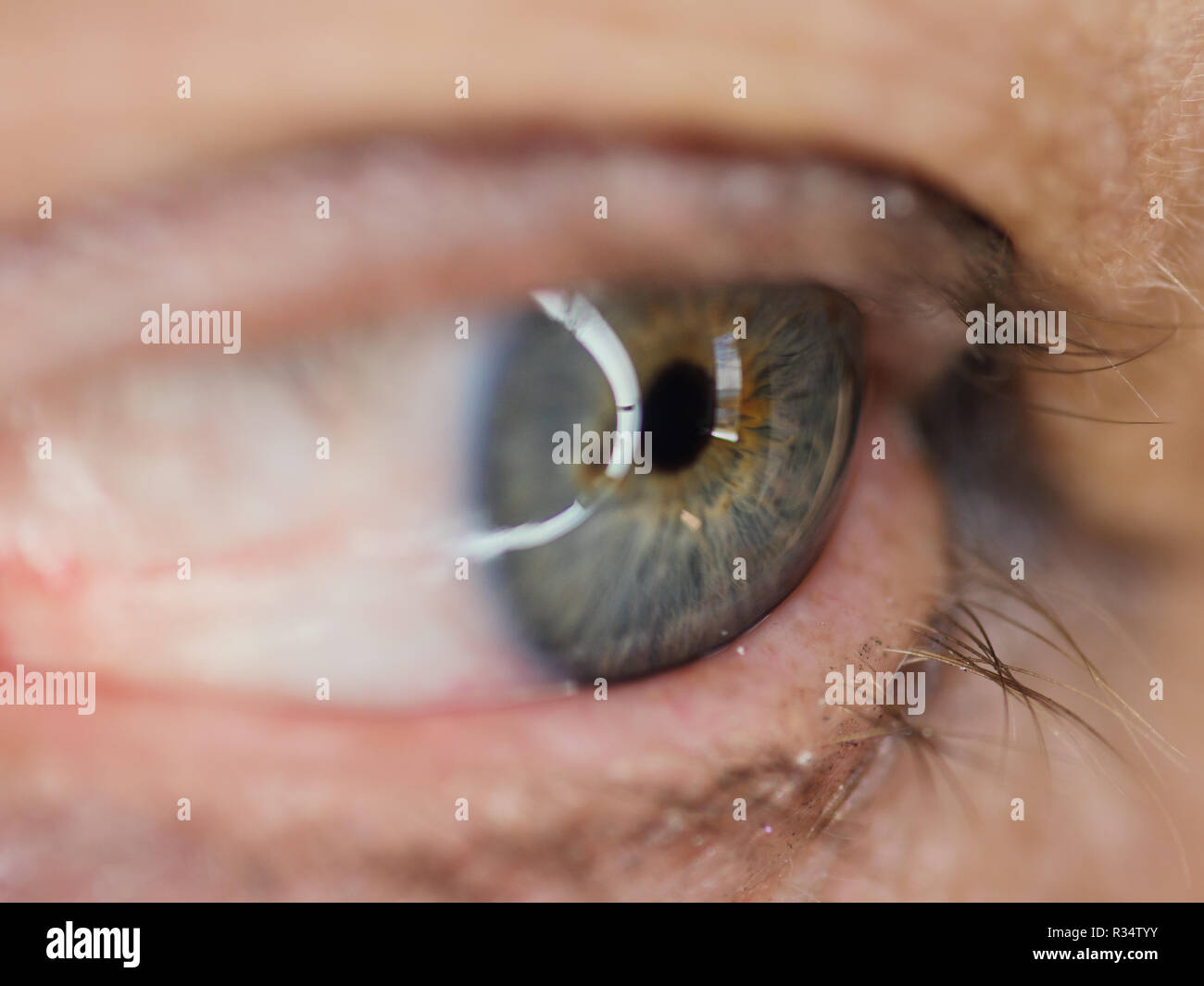 Eyelid optical hi-res stock photography and images - Alamy
