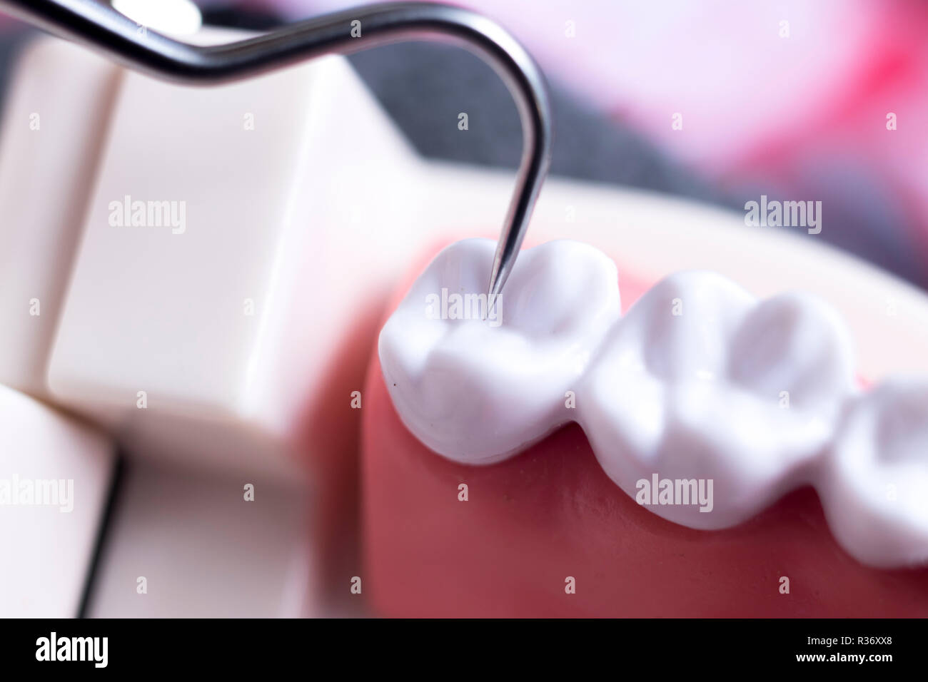 Dentist cleaning teeth with titanium metal tooth pick instrument to ...