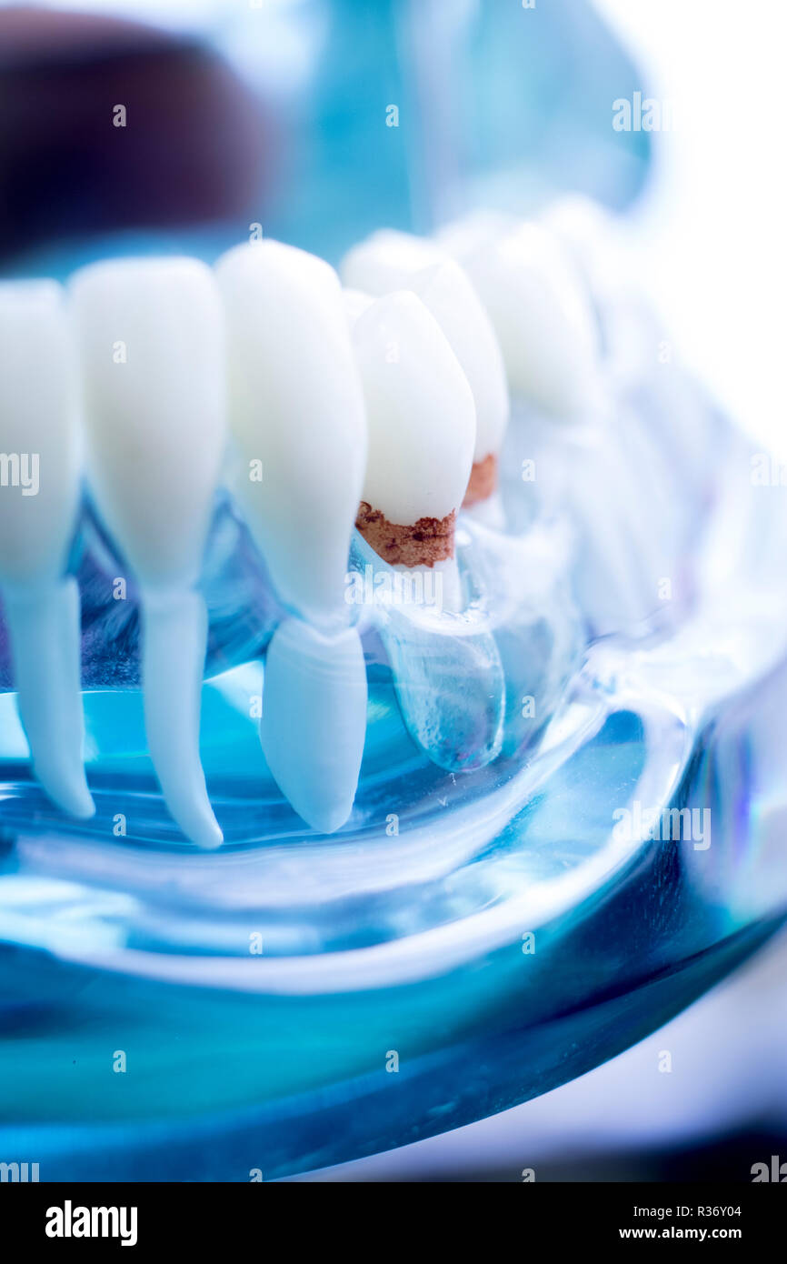 Dentist dental teeth teaching model showing each tooth and gum for ...