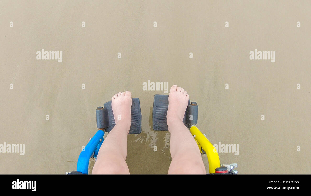 Child foot disabled hi-res stock photography and images - Alamy