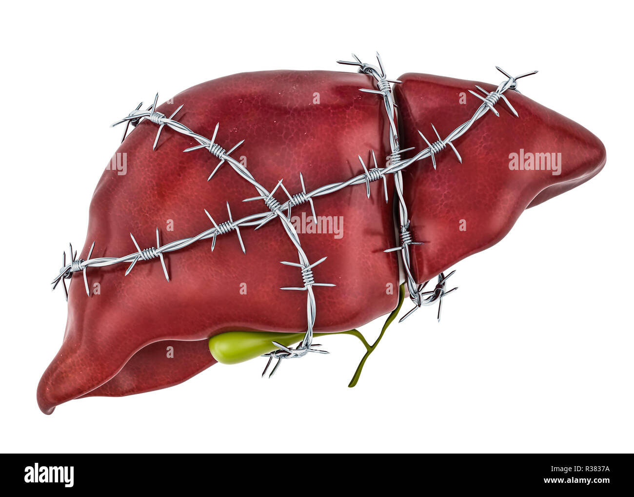 Liver Pain concept. Human liver with barbed wire. 3D rendering isolated ...