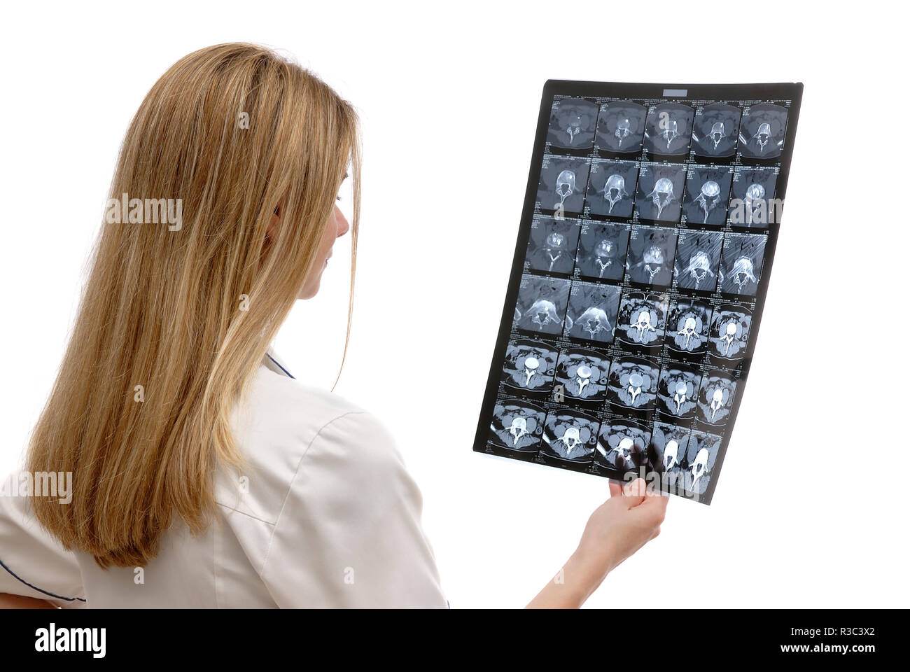 Medical examination - Doctor is watching ct-scan Stock Photo - Alamy