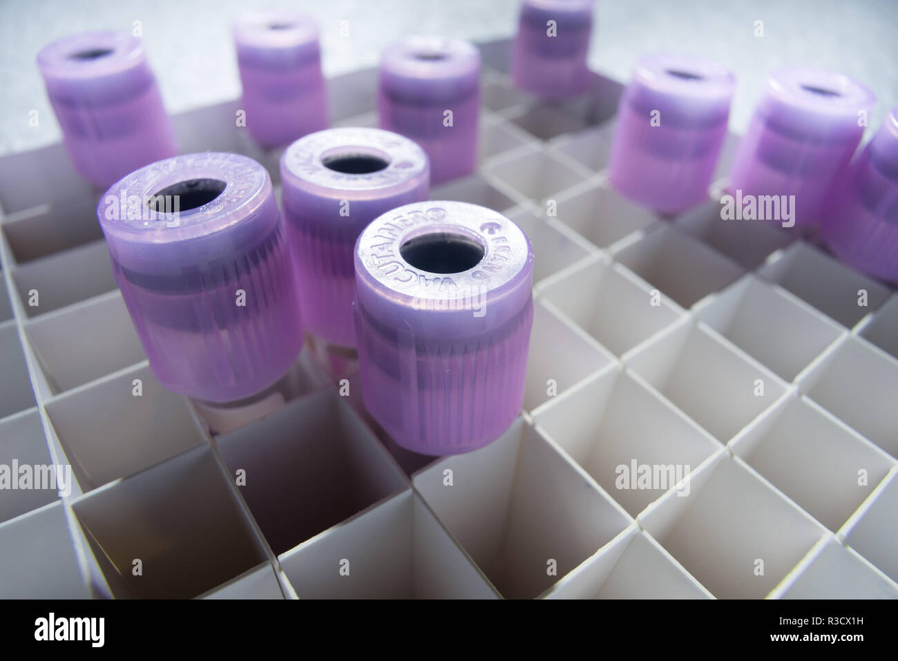 Medical specimen bottles hi-res stock photography and images - Alamy
