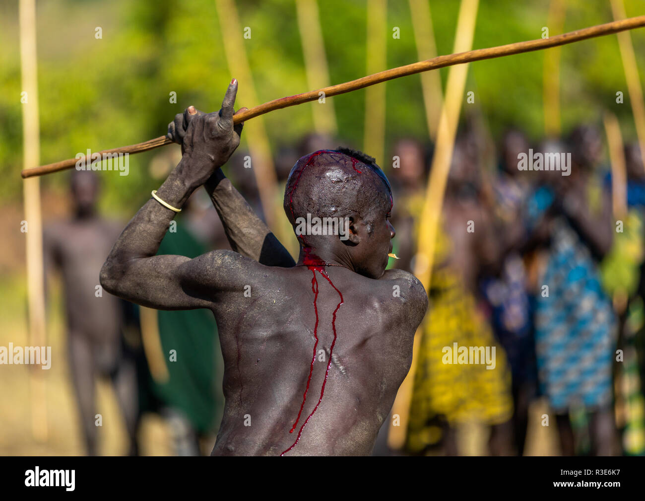 Suri Tribe Warrior Bleeding During A Donga Stick Fighting Ritual Omo Valley Kibish Ethiopia
