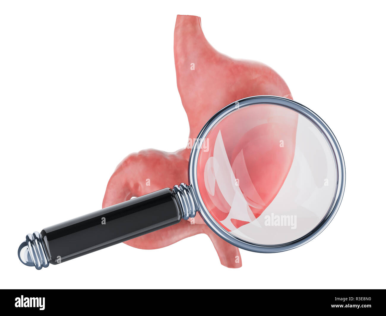 Viral infection painful human Cut Out Stock Images & Pictures - Alamy