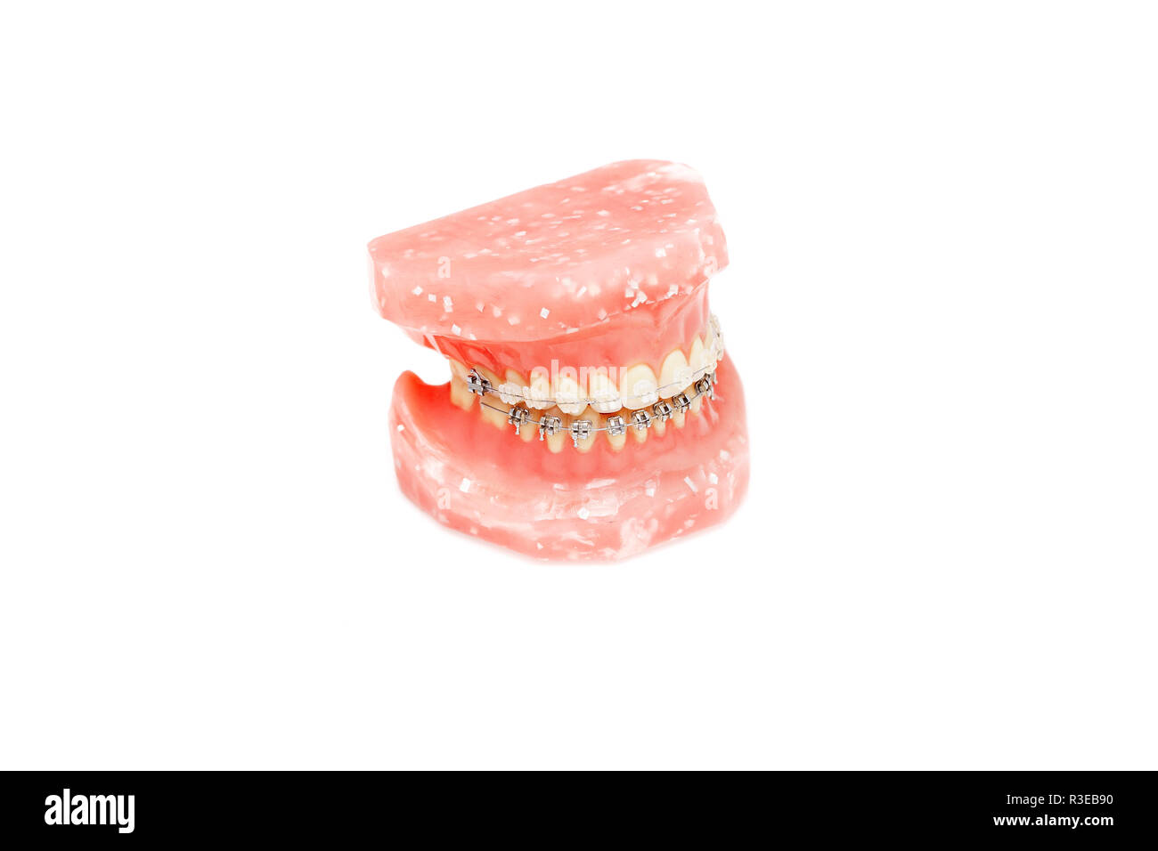 Metall wire dental braces on jaw or teeth orthodontic model, isolated ...