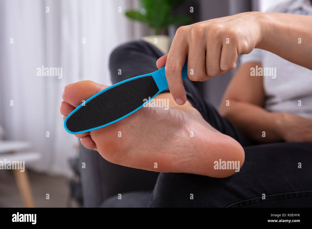 Callus feet man hi-res stock photography and images - Alamy