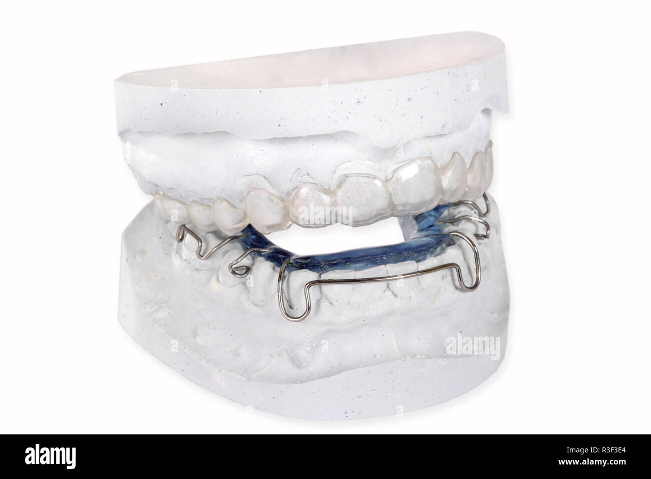 plaster model with a loose buckle up and down Stock Photo - Alamy