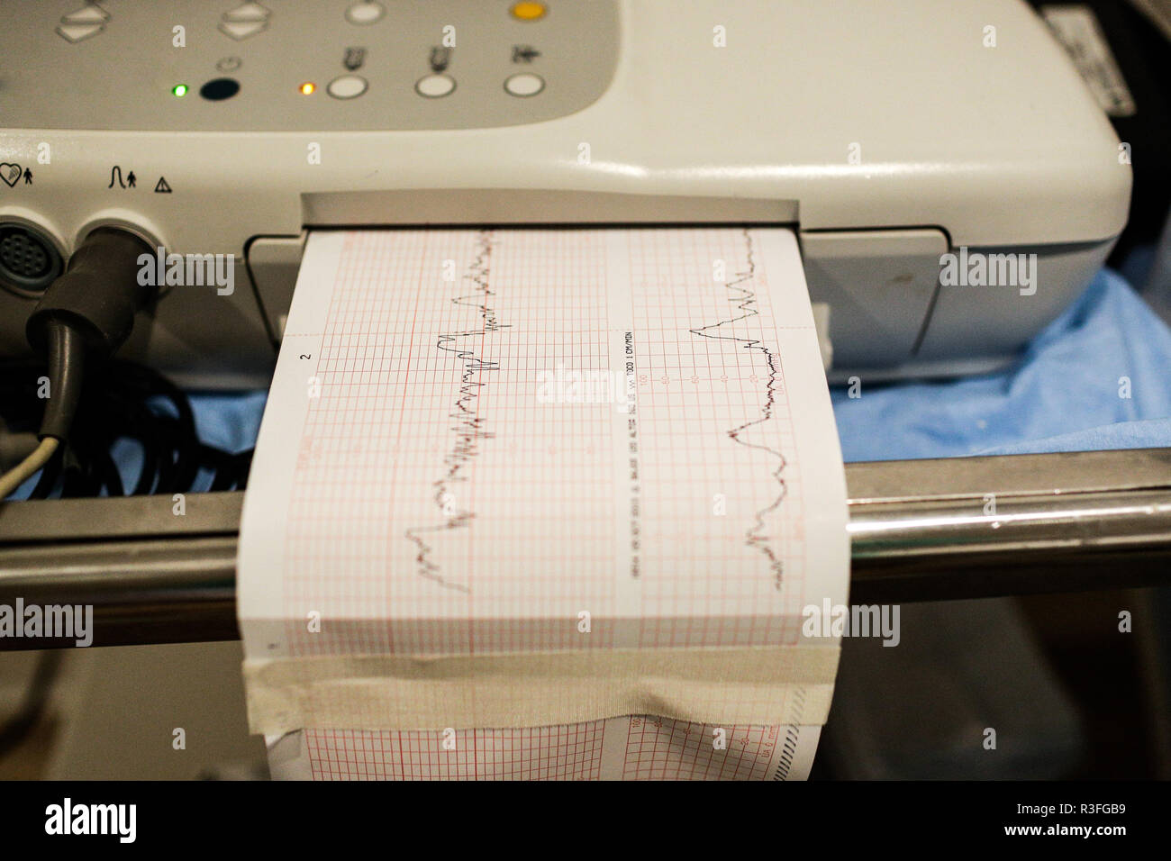 Electrocardiogram medical device showing a patient's health graph Stock ...