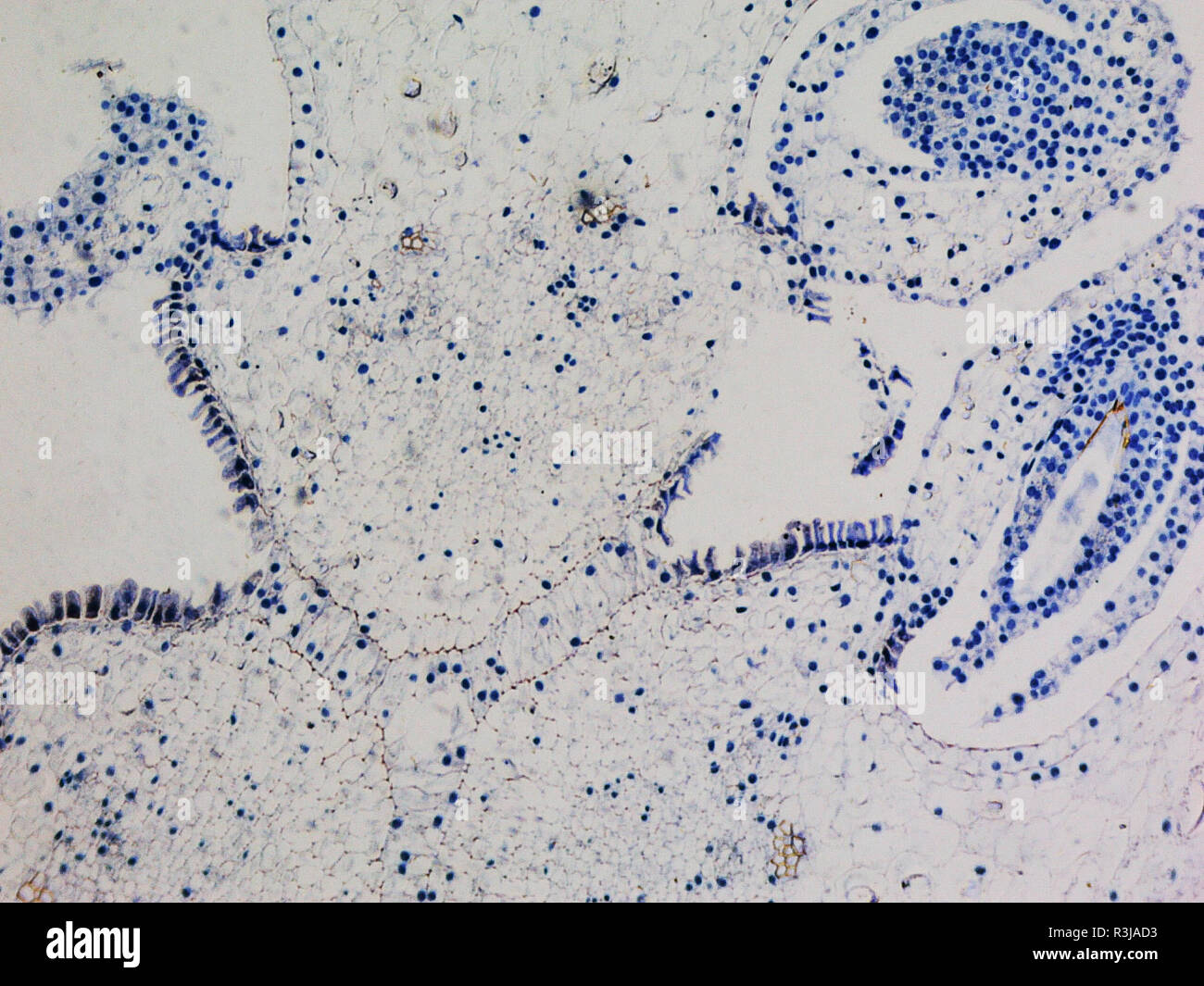Ovary section micrograph hi-res stock photography and images - Alamy Ovary section micrograph hi-res stock photography and images - Alamy