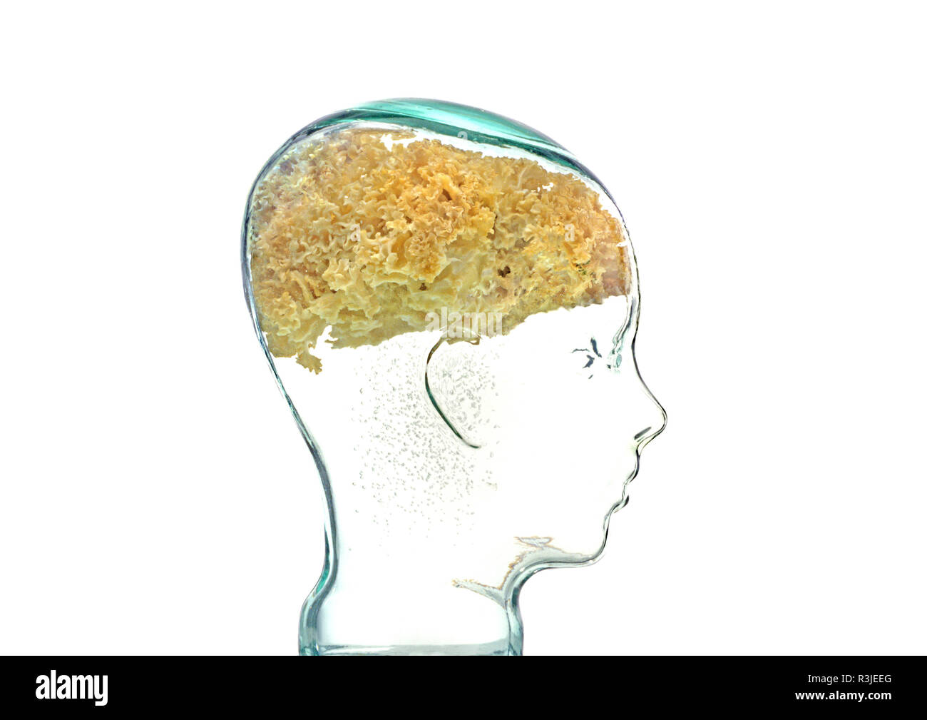 Radiation ulcer hi-res stock photography and images - Alamy