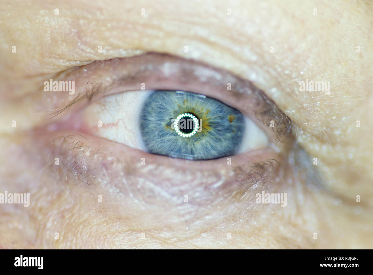 Eye closeup human skin old hi-res stock photography and images - Alamy
