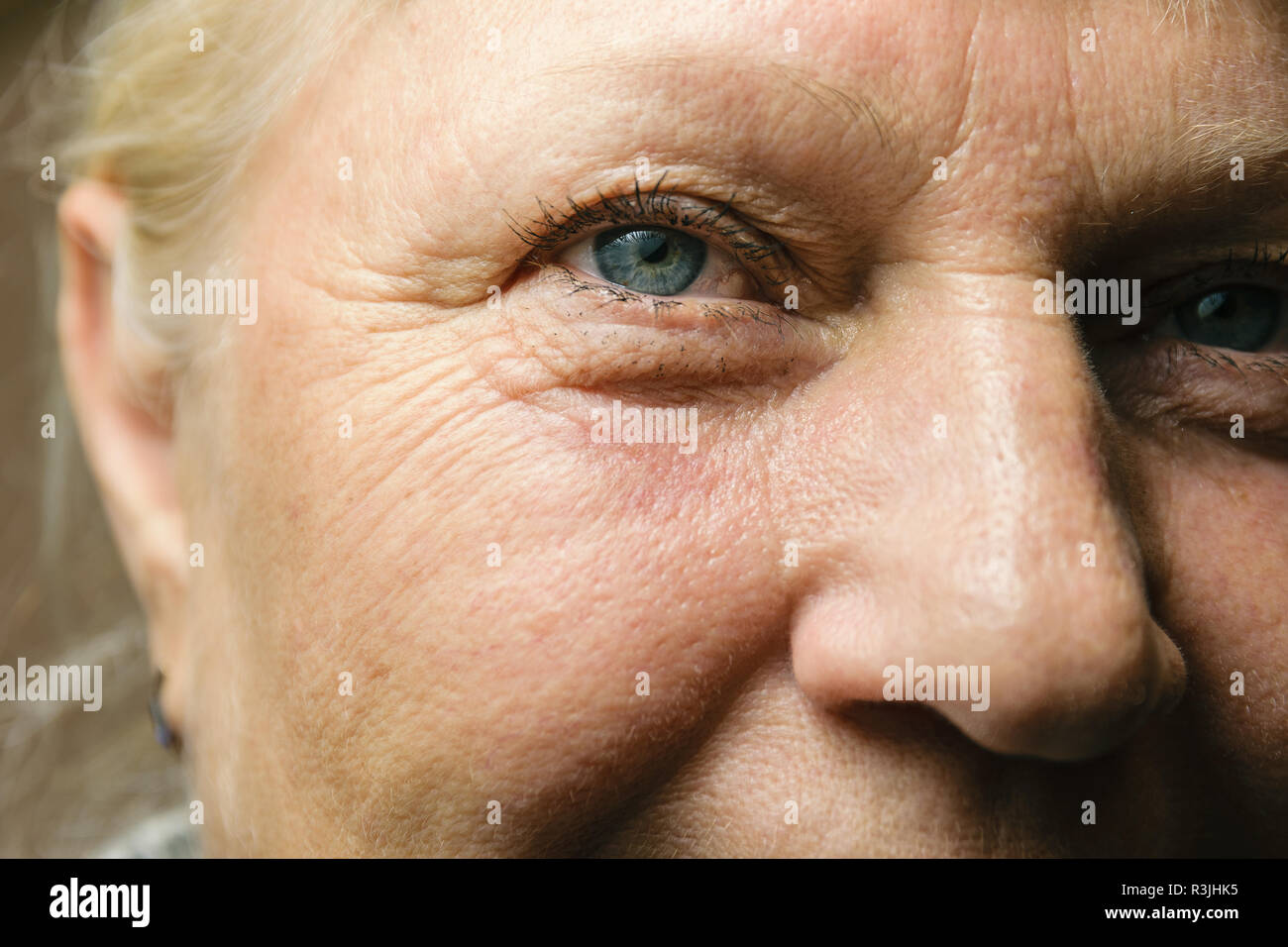 Single Eyelid White People