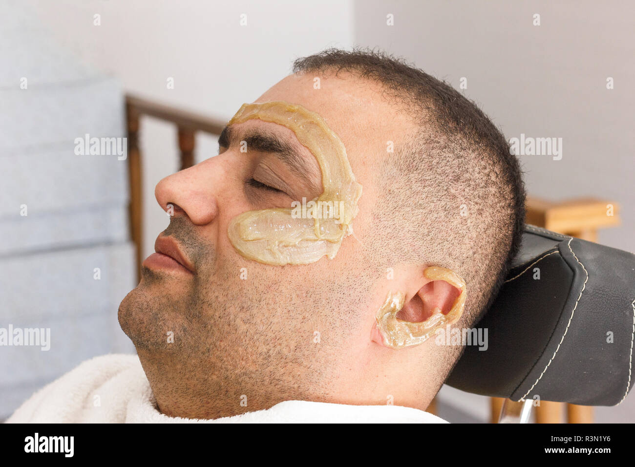 Hair removal. Man's face sugaring epilations in Turkey Stock Photo - Alamy