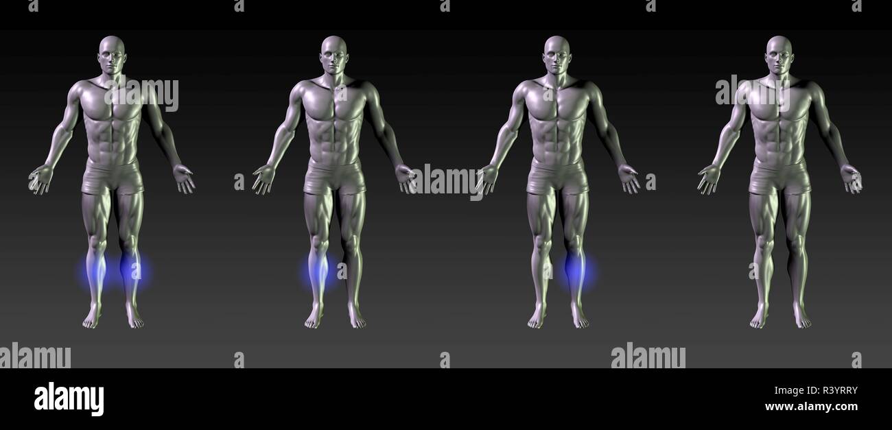 Shin splints hi-res stock photography and images - Alamy