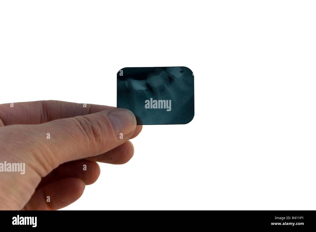 X-ray of human teeth Stock Photo - Alamy
