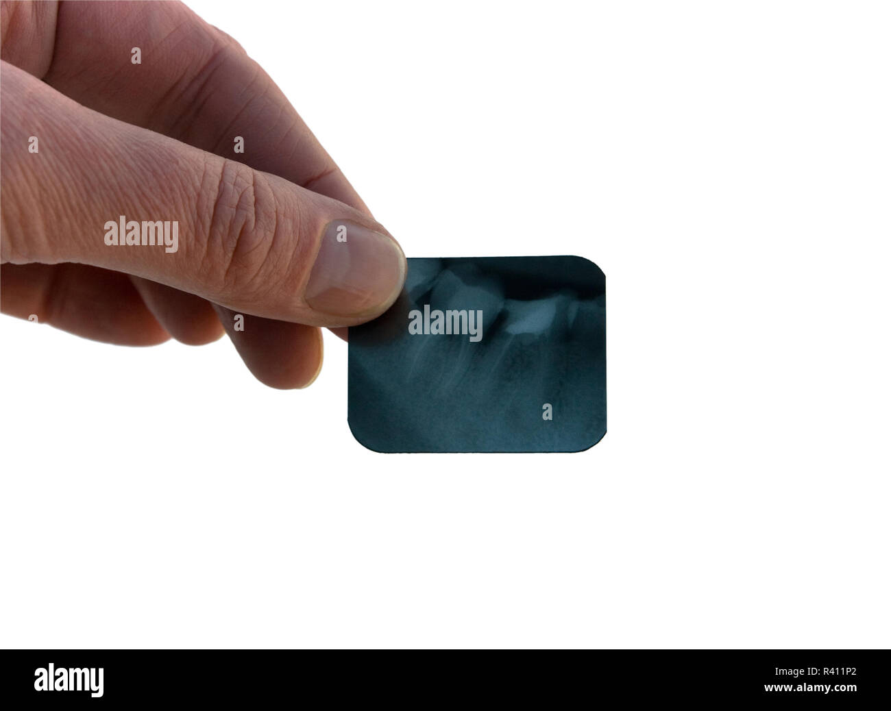 X-ray of human teeth Stock Photo - Alamy