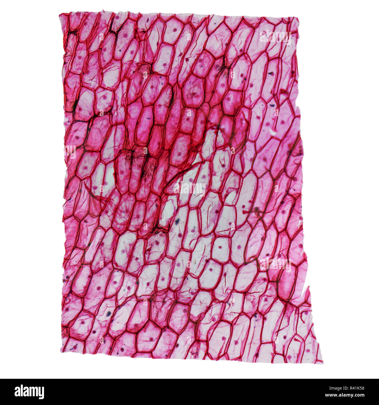 Labeled Red Onion Cell How To Use An Onion For Your Osmosis Lab