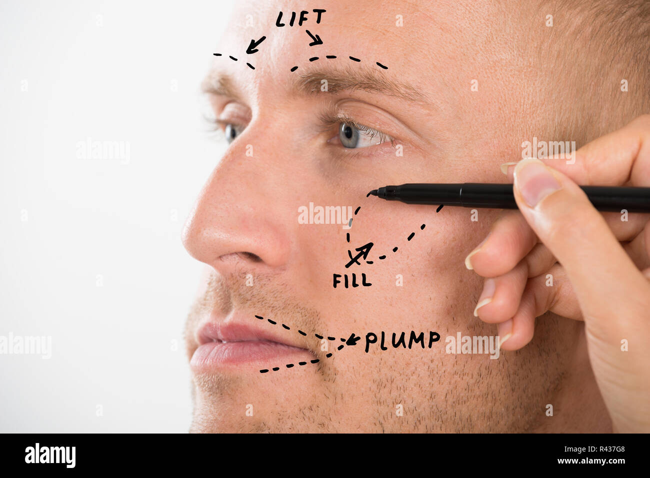 Men for plastic surgery hi-res stock photography and images - Alamy