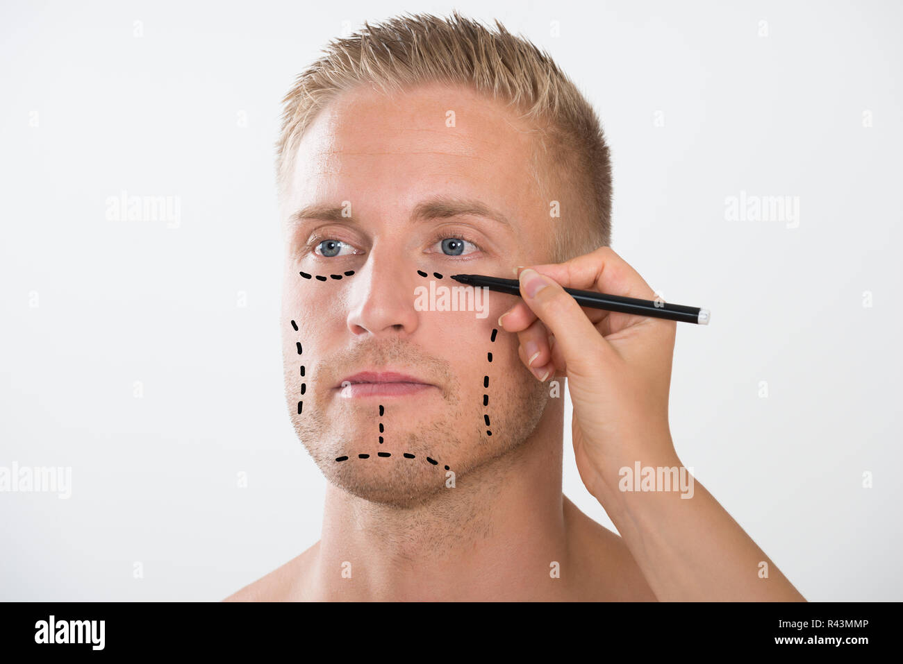 Man With Correction Mark For Plastic Surgery Stock Photo - Alamy