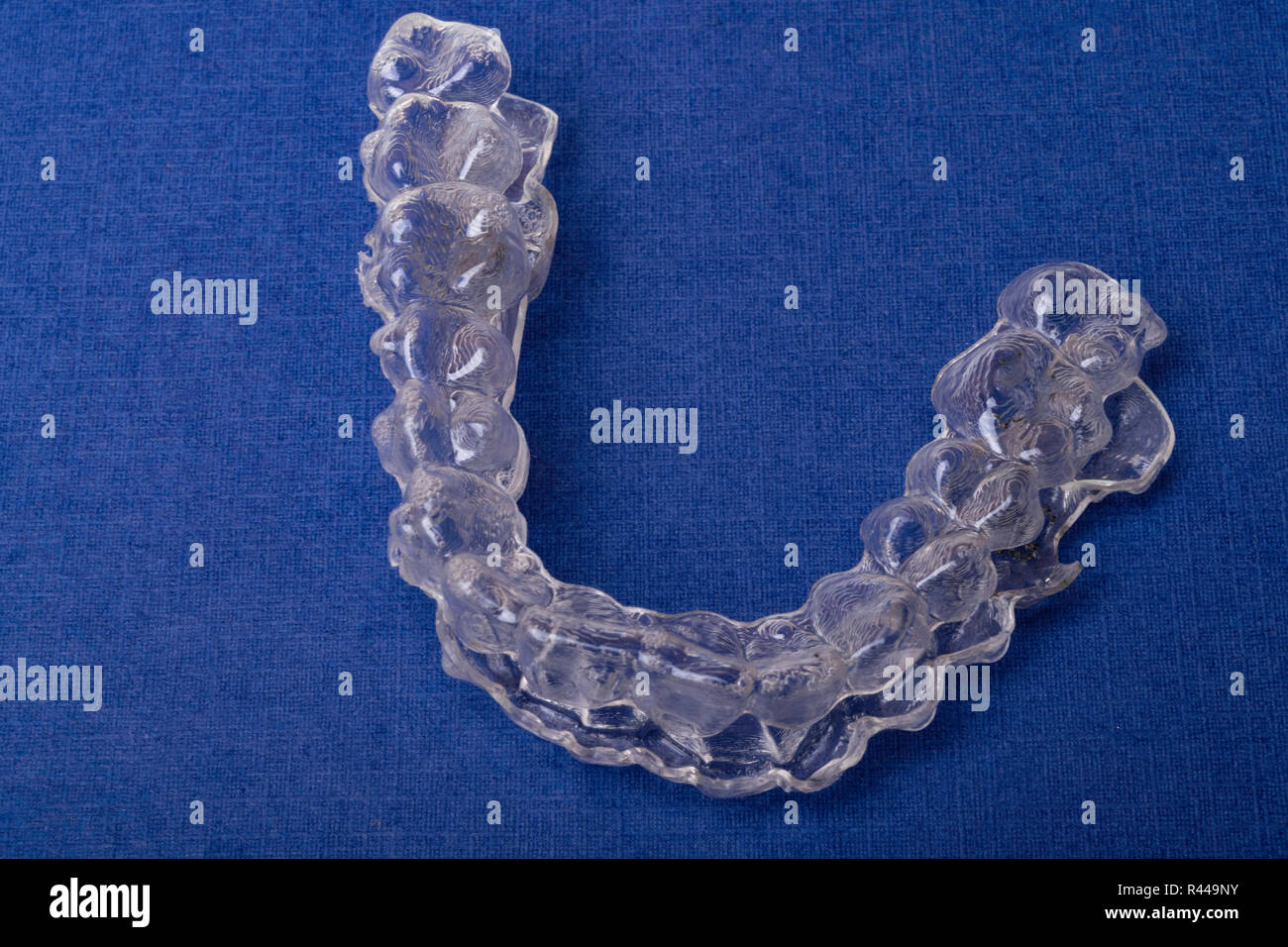 teeth braces or aligner. A way to have a beautiful smile and white ...