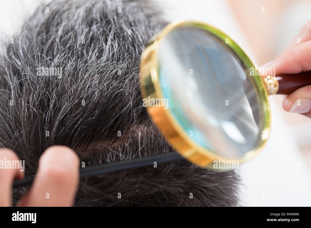 Dermatologist Checking Patient's Hair Stock Photo - Alamy