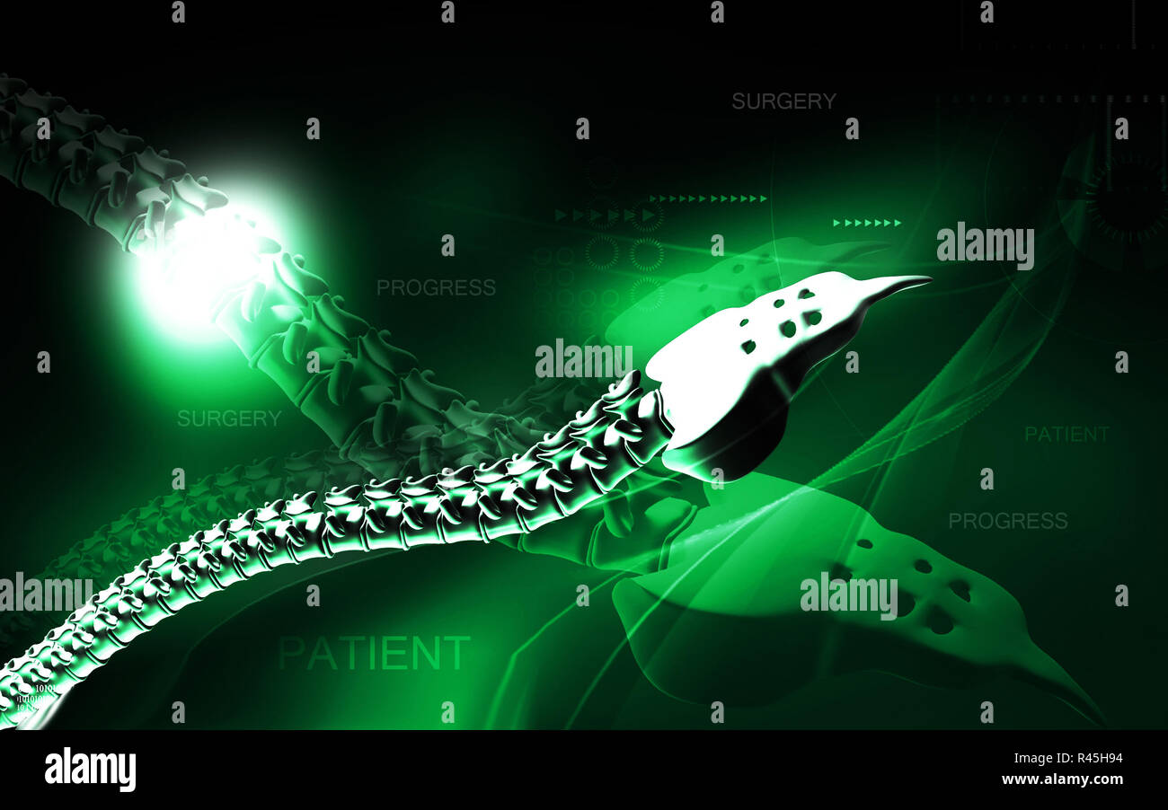 Back bone hi-res stock photography and images - Alamy