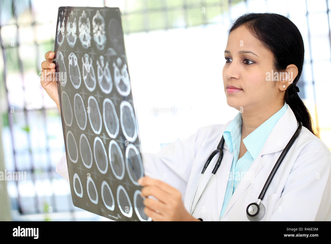 Female doctor examining a brain computerized tomography scan Stock ...
