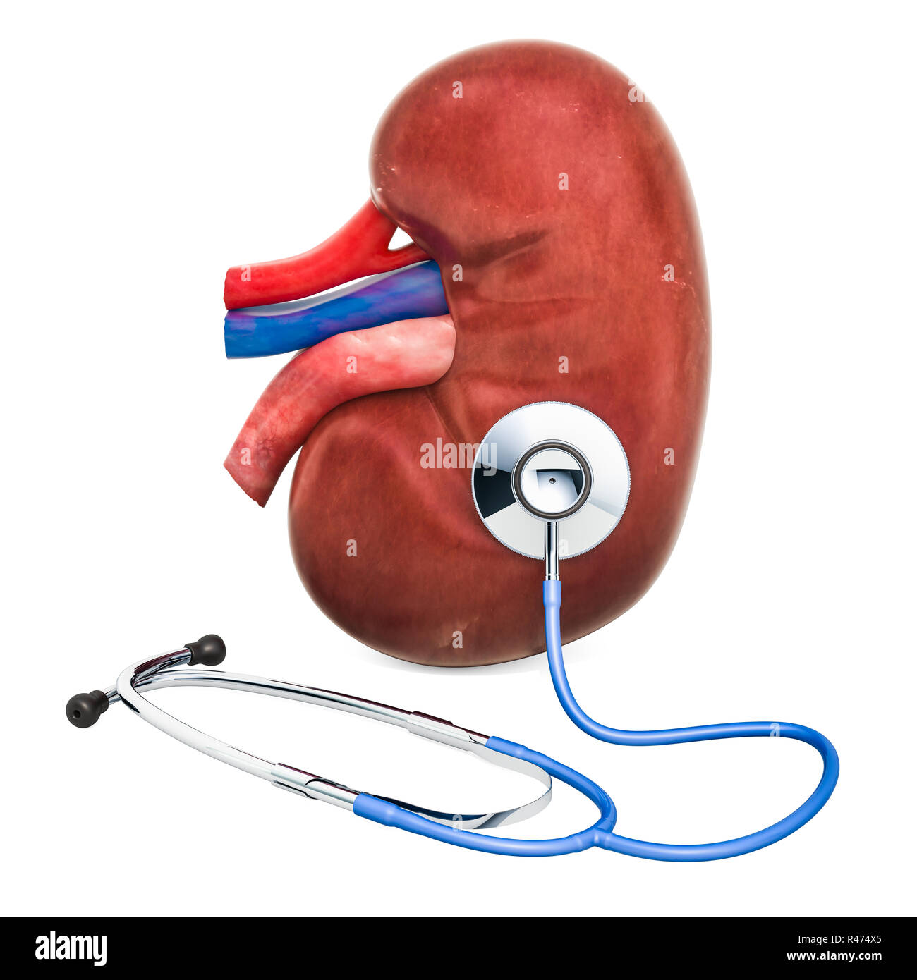 Kidney stones treatment hi-res stock photography and images - Alamy
