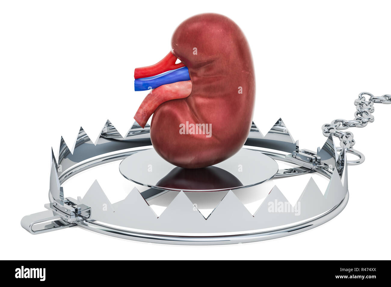 Kidney Pain concept. Human kidney inside bear trap. 3D rendering ...
