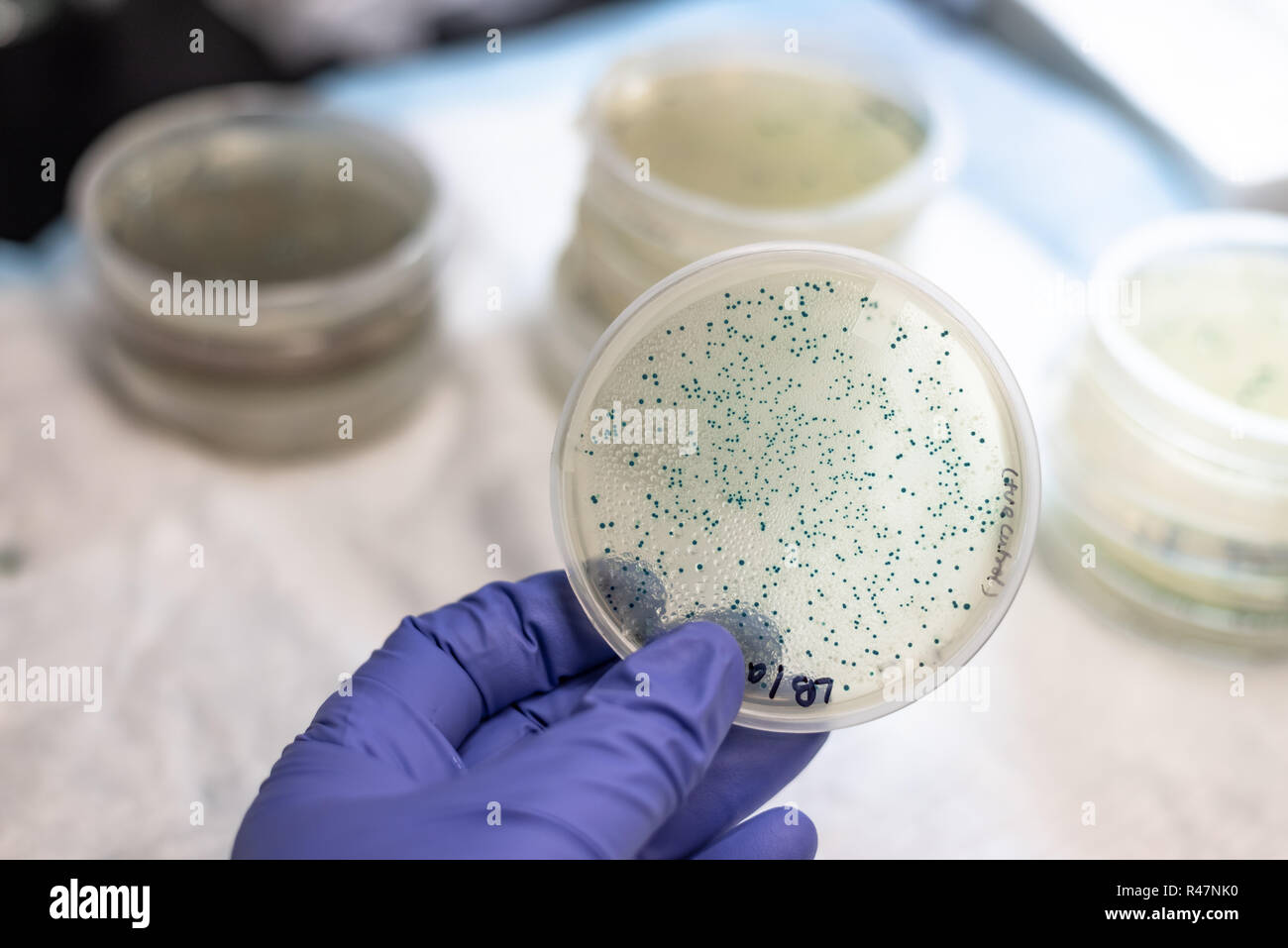E coli hi-res stock photography and images - Alamy