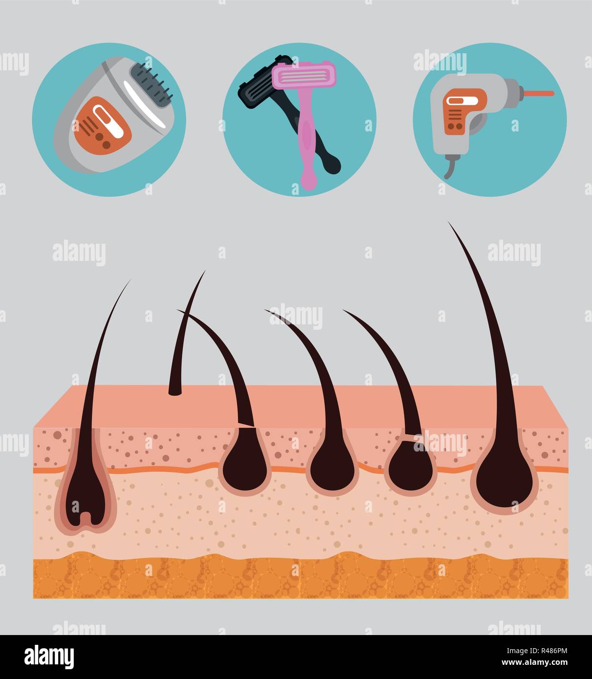 layers skin structure with hair removal icons vector illustration ...