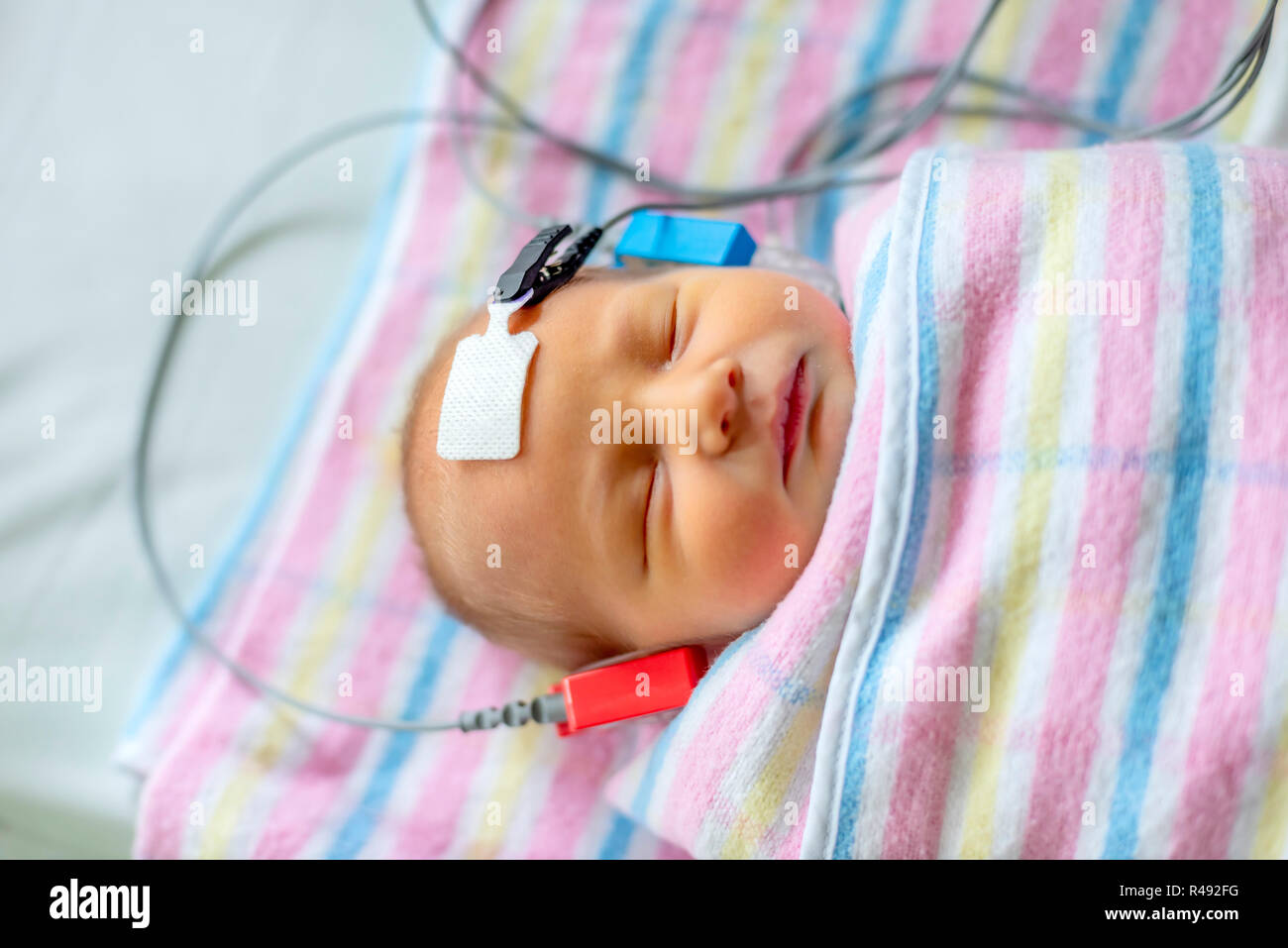 hearing test of a sleeping newborn at hospital Stock Photo - Alamy