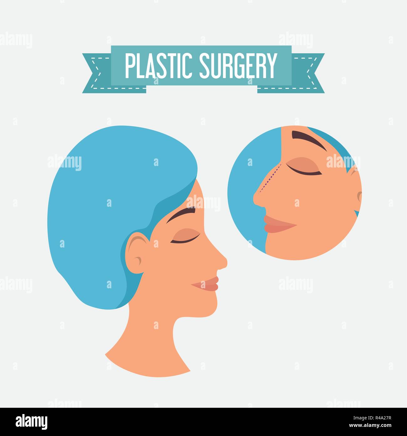 woman plastic surgery process vector illustration design Stock Vector ...