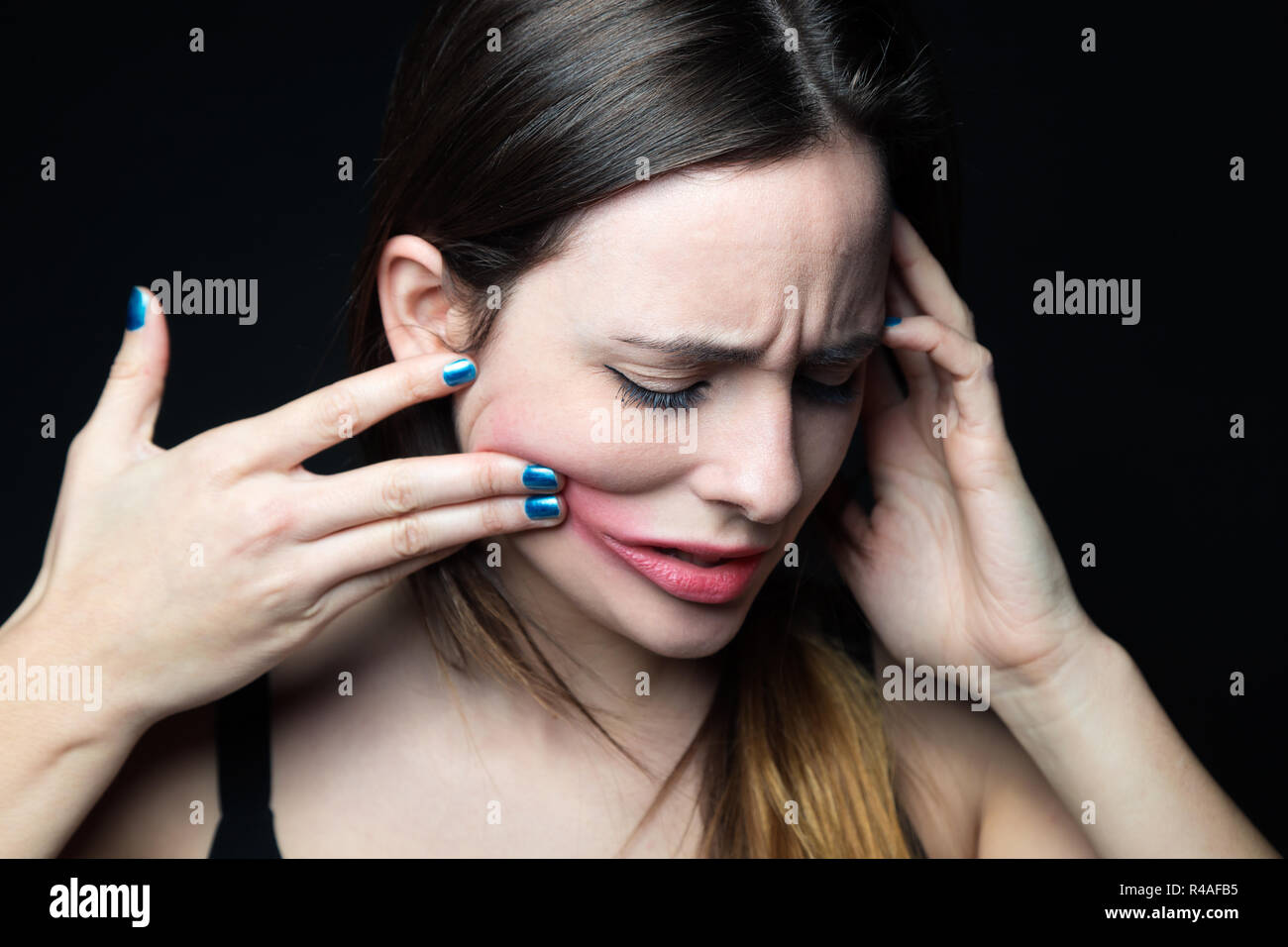 Desperate young woman touching her face. Concept of abuse and despair ...