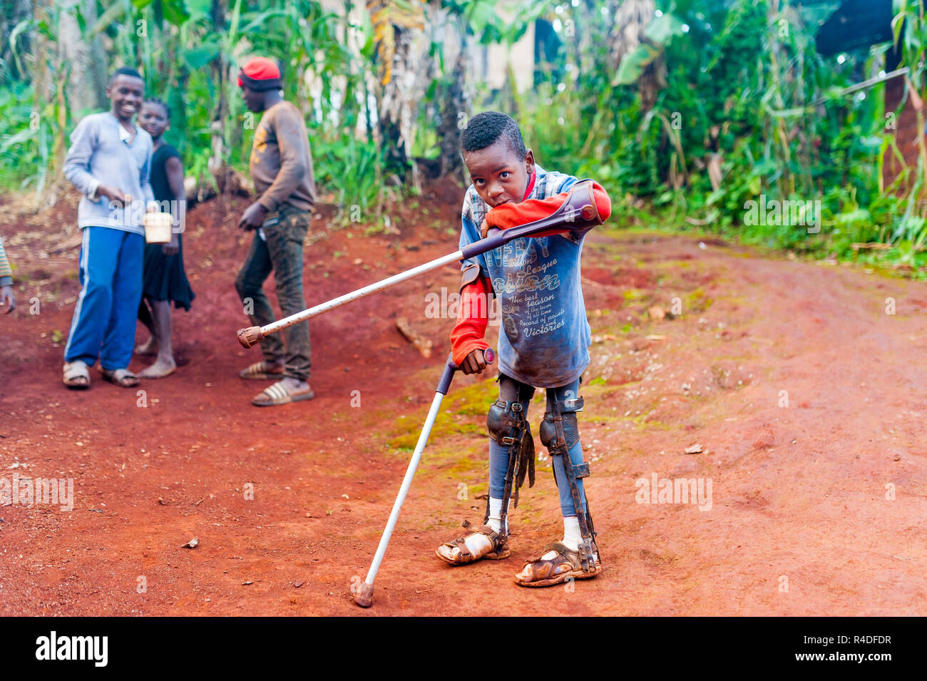 Bafoussam, Cameroon - 6 august 2018: young african boy victim of war ...